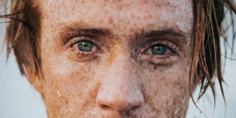 ¿Por qué tengo un derrame ocular o hiposfagma? - Blog SaludOnNet