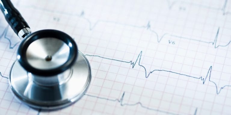 Bradicardia sinusal - Blog SaludOnNet