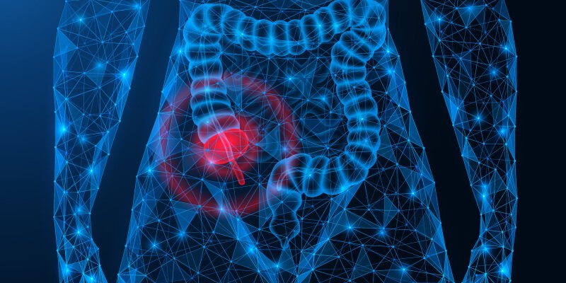 Apendicitis: qué es, causas y síntomas - Blog SaludOnNet